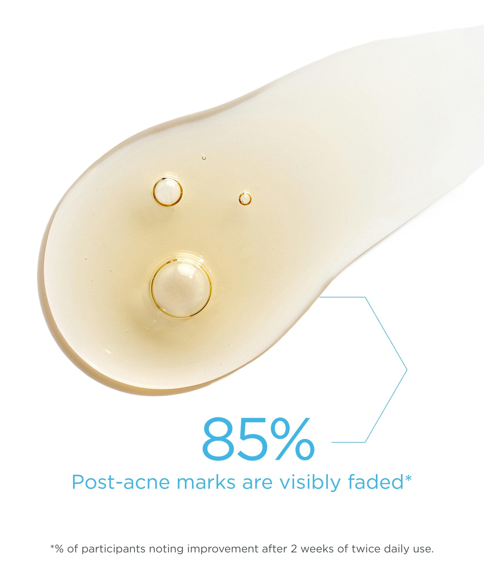 Post-Acne Mark Correcting Serum – NEOSTRATA® of Canada